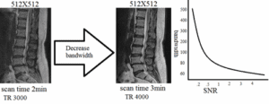 MRI resolution and image quality | How to manipulate mri scan parameters