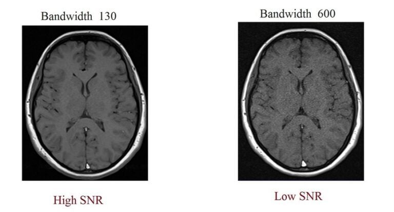 MRI bandwidth and image quality | How to manipulate transmitter ...