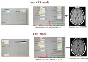 MRI bandwidth and image quality | How to manipulate transmitter ...