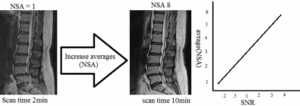 MRI resolution and image quality | How to manipulate mri scan parameters