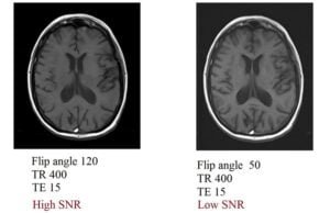 Signal-to-Noise Ratio (SNR) in MRI | Factors affecting SNR