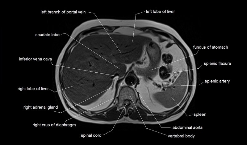 Cross Sectional Anatomy Ct Cross Sectional Anatomy Kenhub Cross Sectional Anatomy Ct Cross Sectional Anatomy Kenhub