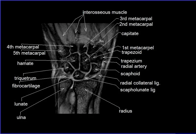 Hand Mri Anatomy