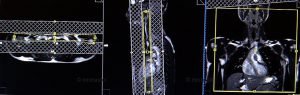 magnetic resonance angiography(MRA) upper arm protocols and planning ...