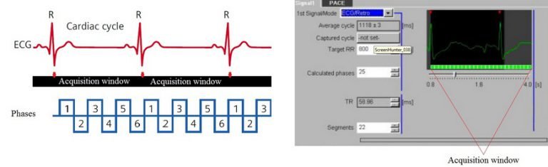 Cardiac MRI protocols, Planning and Techniques | Positioning for ...