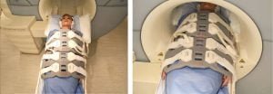 Fetal Brain MRI | Fetal Brain Scan Protocol and Planning