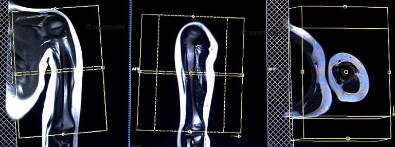 TWIST MRA | TWIST MRA arm protocol and planning | Dynamic MRA