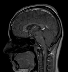 PLAN MRV BRAIN loc - mrimaster