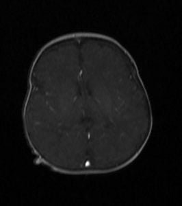 PLAN PED BRAIN localizer - mrimaster