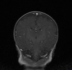 PLAN PED BRAIN localizer - mrimaster