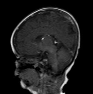 PLAN PED BRAIN localizer - mrimaster