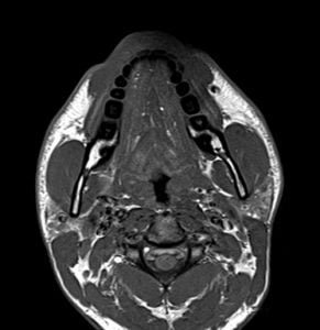 MRI Face axial T1 images - mrimaster