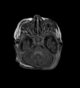 PLAN PED BRAIN mprange axi - mrimaster