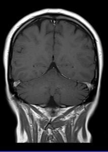 PLAN BRAIN IMAGE t1 cor post gd - mrimaster