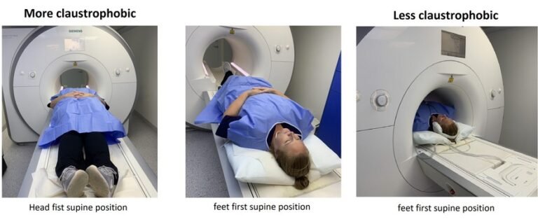 MRI Artifacts | MRI Motion artifact | Ghosting artifact mri