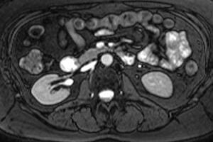 PLAN KUB axi trufi fat sat - mrimaster