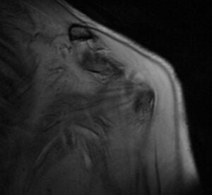 PLAN SHOULDER cor medic - mrimaster