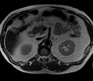 PLAN TESTIS axi t2 - mrimaster
