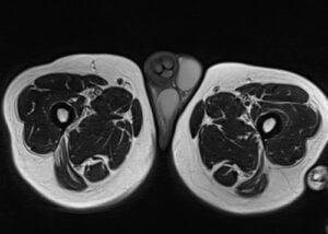 PLAN TESTIS axi t2 - mrimaster