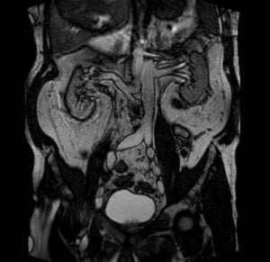 PLAN MRV ABD LOC - mrimaster