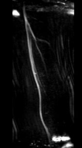 PLAN MRA W BODY LOC UPPER LEG PC - mrimaster