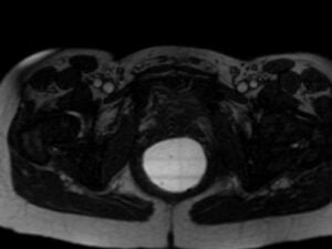 PLAN PROCTO GRAM loc - mrimaster