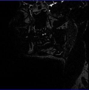 PLAN SIALOGRAPHY sag space sub man - mrimaster