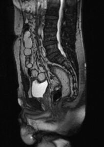 PLAN TESTIS loc - mrimaster