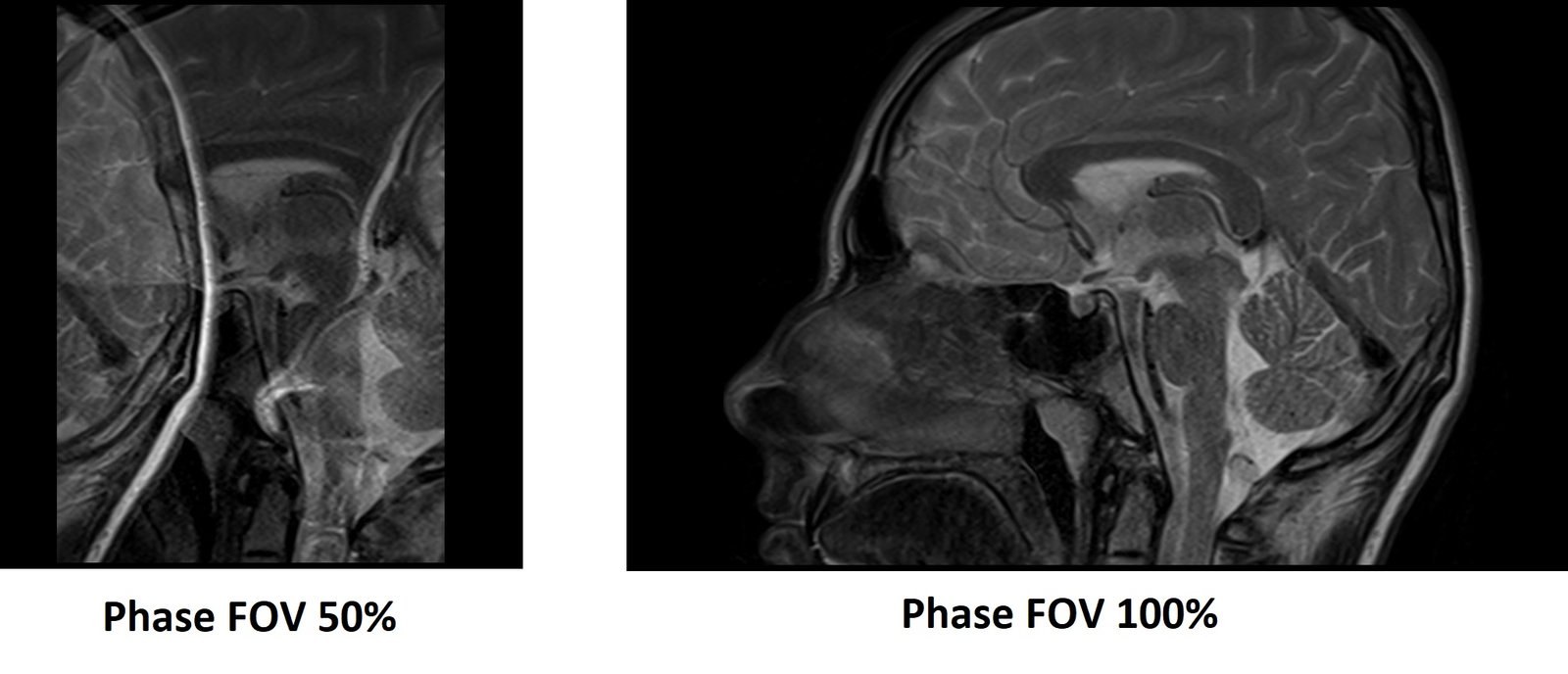 Aliasing/Wrap Around Artifact