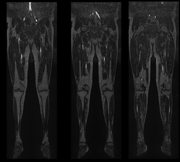 QISS MRA| QISS MRI Protocol and planning