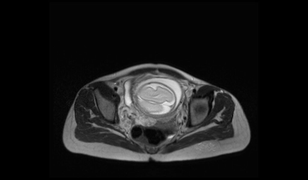 fetal brain mri axial large FOV images - mrimaster