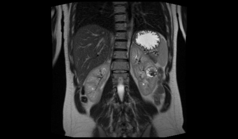 PLAN MRI KIDNEYS loc - mrimaster