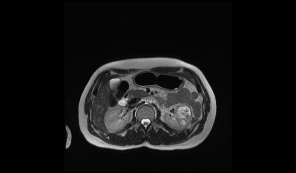 PLAN MRI KIDNEYS loc - mrimaster