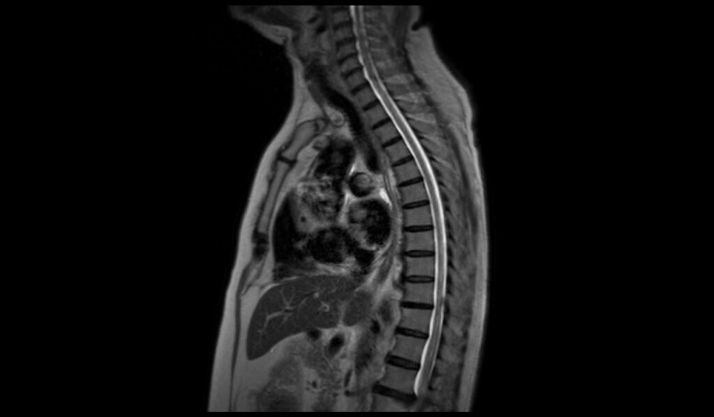 PLAN CHEST loc - mrimaster