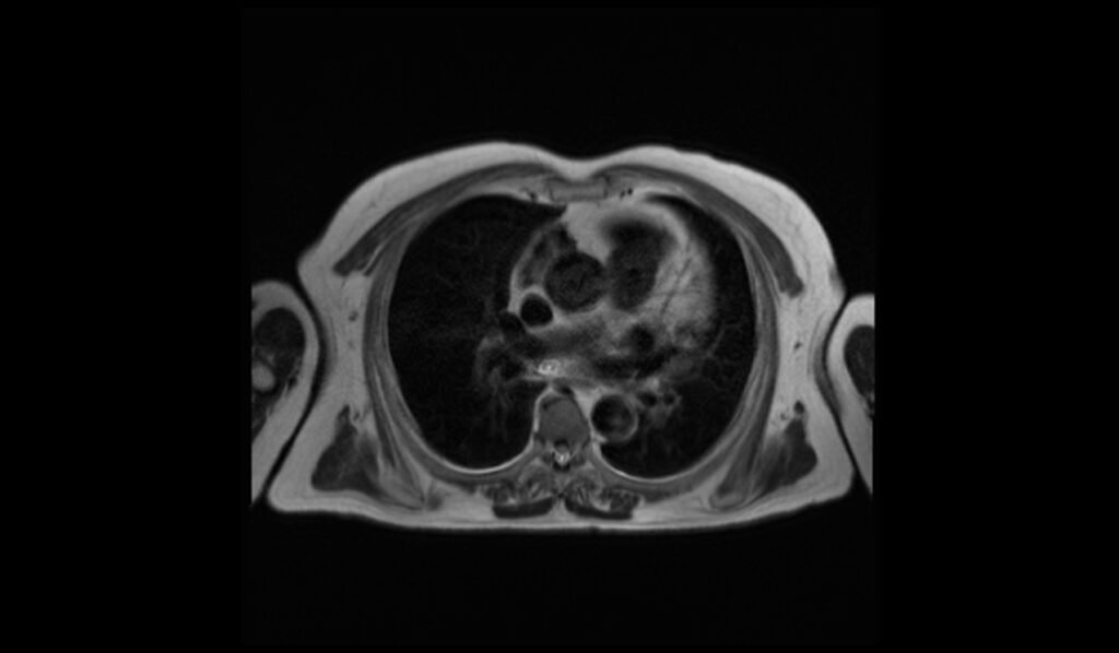 PLAN CHEST loc - mrimaster