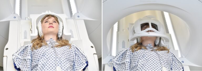 CSF Flow Chiari I Malformation MRI | Chiari I Malformation MRI protocol ...