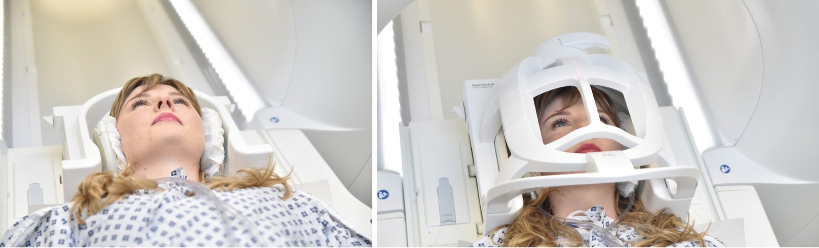 MRI Paranasal Sinuses (PNS) Planning and Protocols | Indications for ...