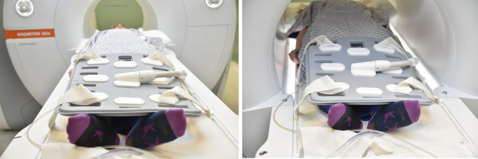 Lower Leg (Tibia and Fibula) MRI Protocols and Planning | Indications ...