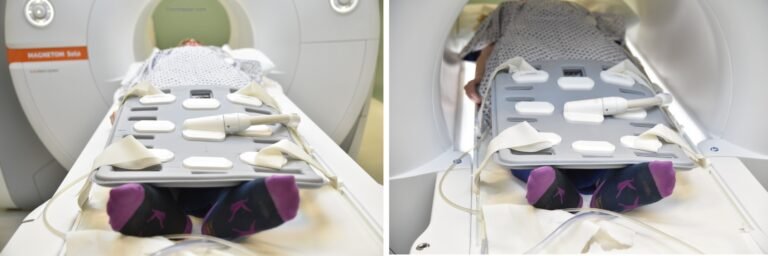 Lower Leg (Tibia and Fibula) MRI Protocols and Planning | Indications ...
