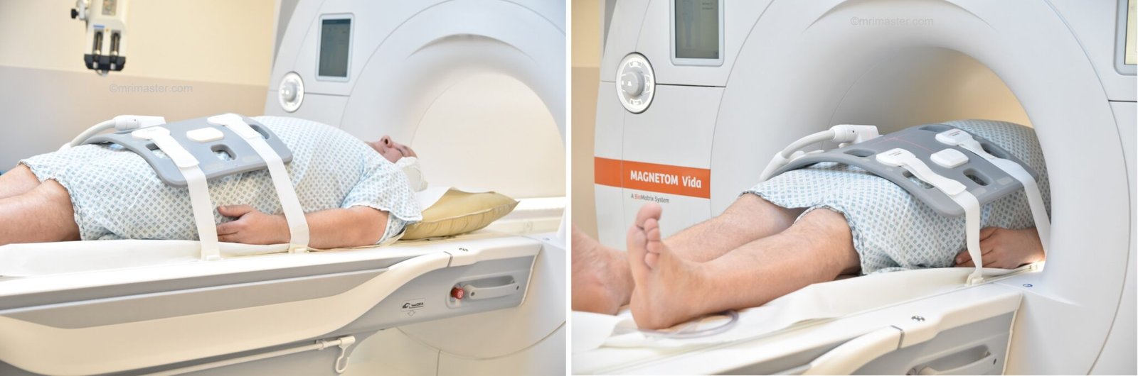 Urinary bladder MRI Protocols and Planning | Indications for MRI ...