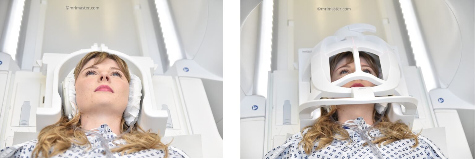 Cerebrospinal fluid flow MRI | CSF flow MRI protocol and planning