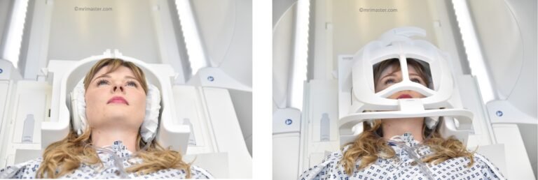 Cerebrospinal fluid flow MRI | CSF flow MRI protocol and planning