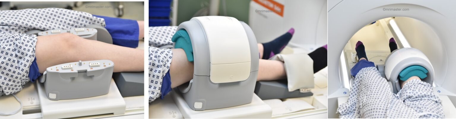 MRI Knee Protocols and Planning | Indications for MRI Knee Scan