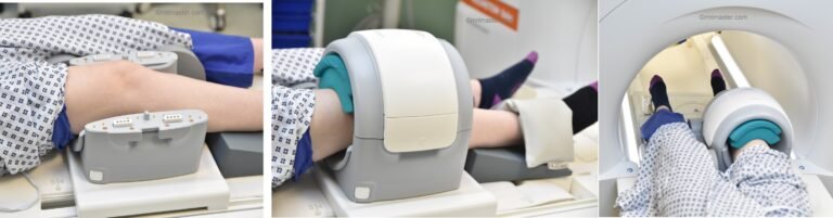MRI Knee Protocols and Planning | Indications for MRI Knee Scan