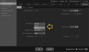 MRI Specific Absorption Rate(SAR) | how to calculate MRI SAR