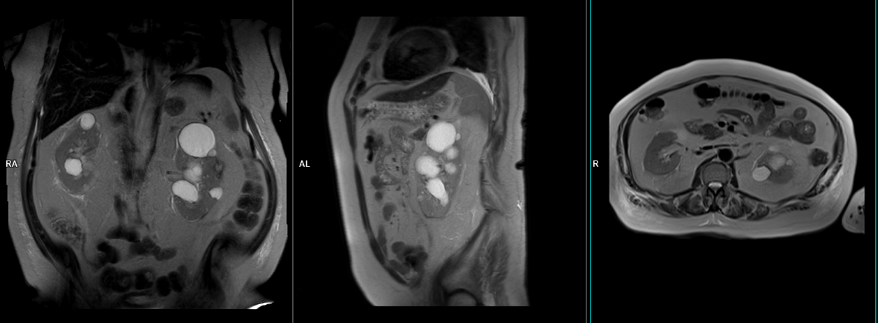 NATIVE MRI | Native Space MRI | NATIVE MRA Protocol and Planning
