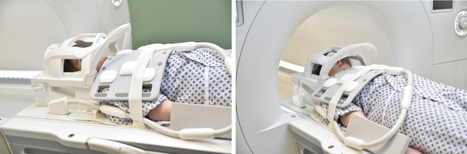 Magnetic Resonance Angiography(MRA) Subclavians Protocols and Planning ...