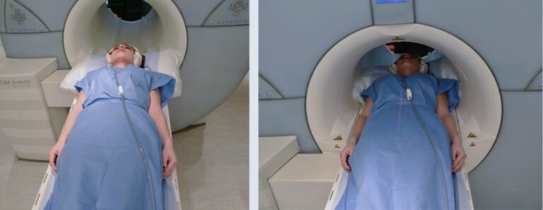 lumbar spine exit forearm view | mri lumbar spine exit forearm view ...