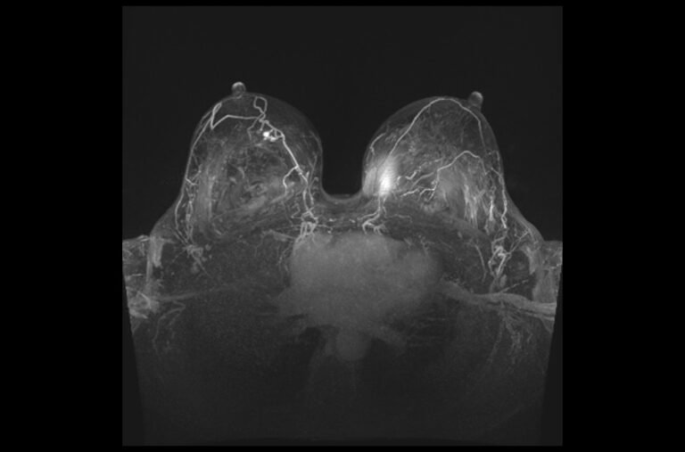 PLAN BREAST DYNAMIC MIP - mrimaster