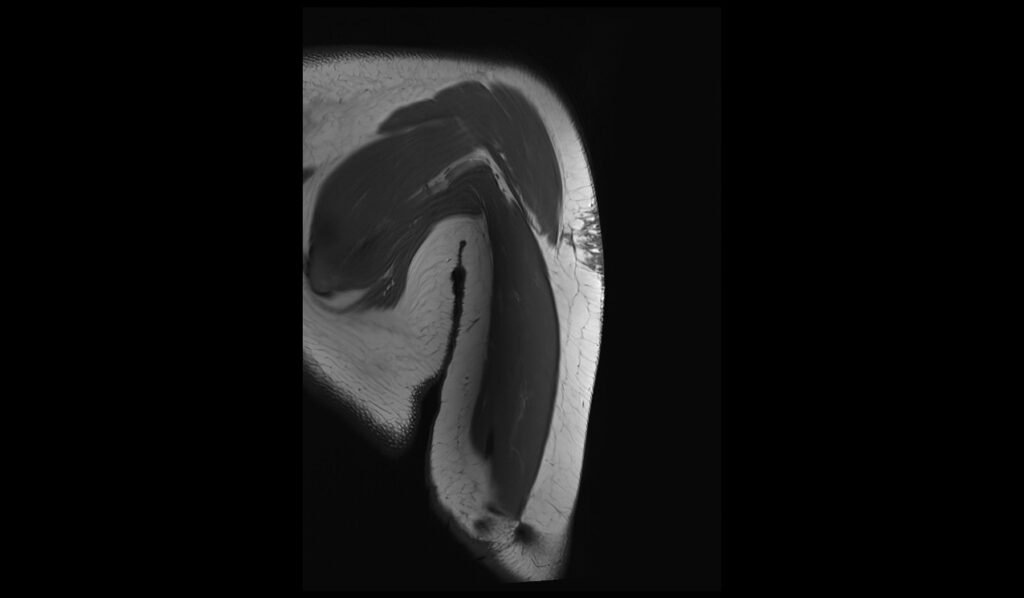 PLAN HUMOROUS cor t1 - mrimaster